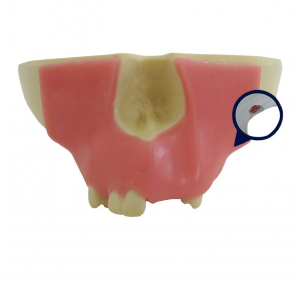 4015 DIG - Maxilar Com 3º Molar Incluso + Gengiva - Harte Instrumentos ...