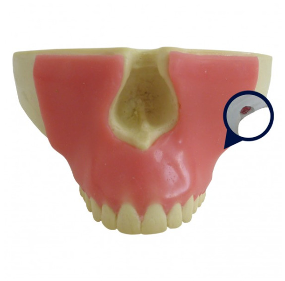 4402 G-01 - Maxila Com Todos Os Dentes e Gengiva + 3º Molar Incluso ...